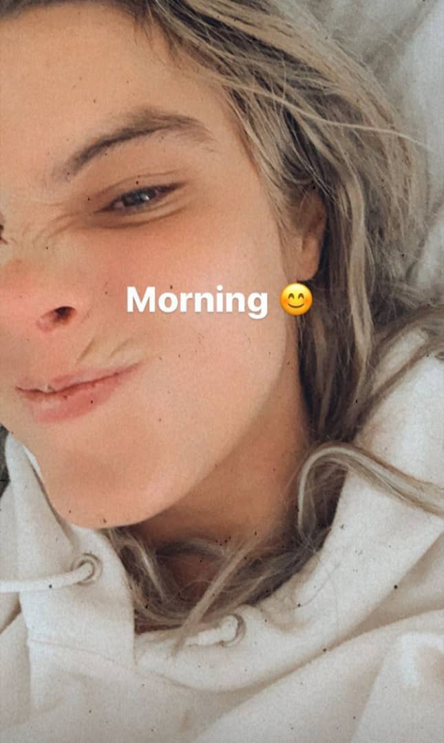 Lele Pons Sufrió Un Aparatoso Accidente Tras Realizar Un Video En Tik